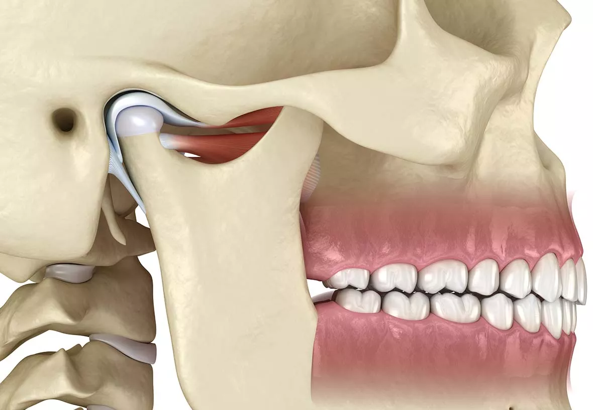 TMJ in Yonge and Lawrence | Dentistry at Fairlawn
